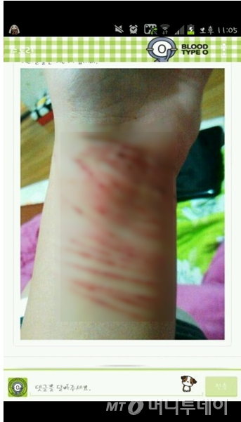 13살 딸 '카스'엔 '7cm 칼빵' 인증샷이… - 인스티즈(instiz) 이슈 카테고리